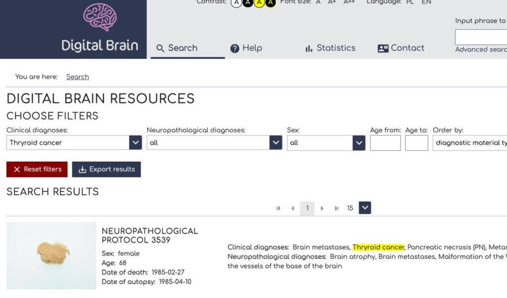 Digital Brain: Plataforma onde pode ver milhares de cérebros digitalizados